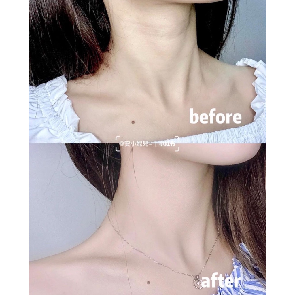 Gold Bond Neck & Chest Firming cream