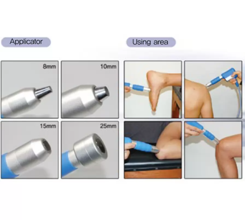 Máy xung kích trị liệu ESWT-1000 ( Stratek - Hàn Quốc )