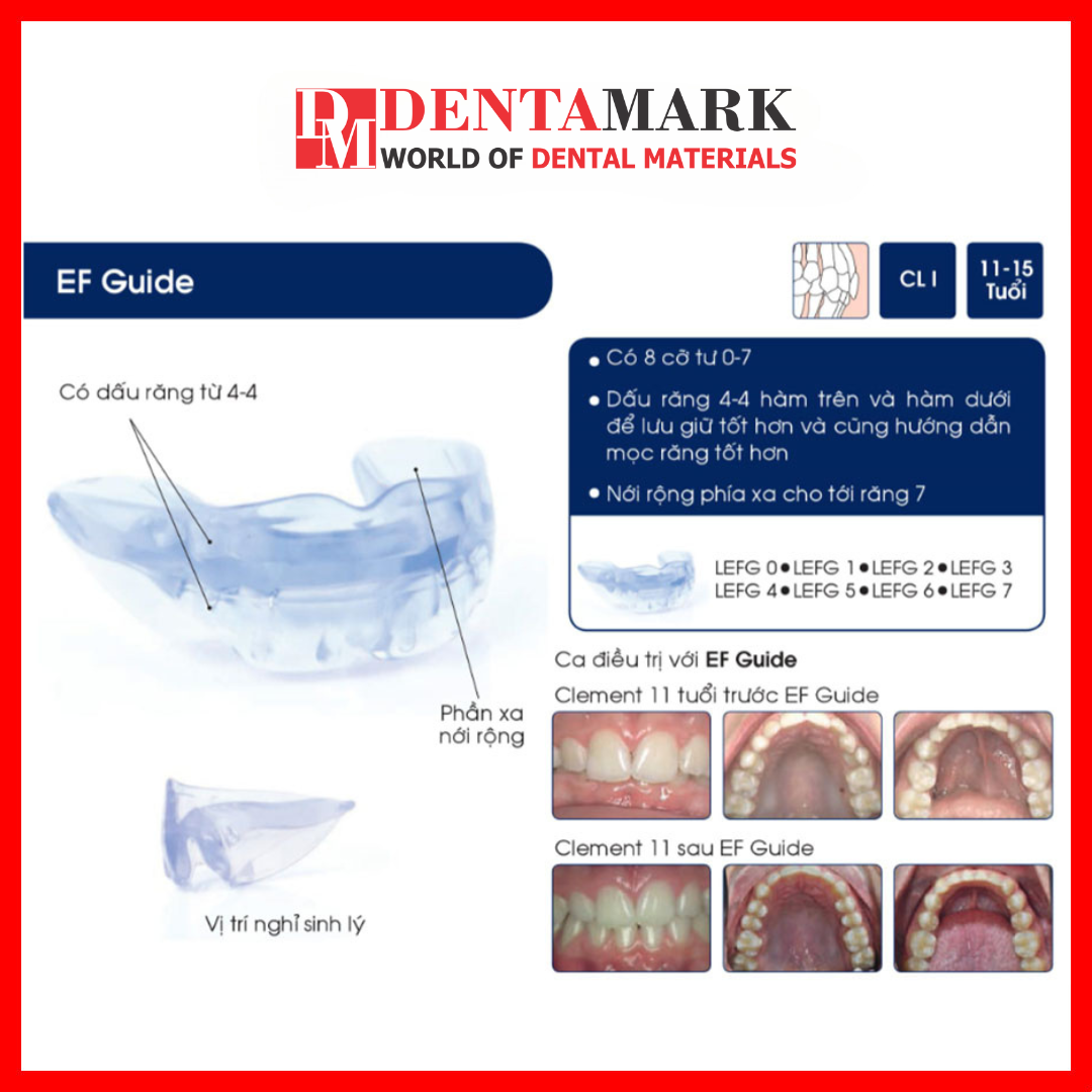 Hàm định hình khớp răng EF Line Orthoplus