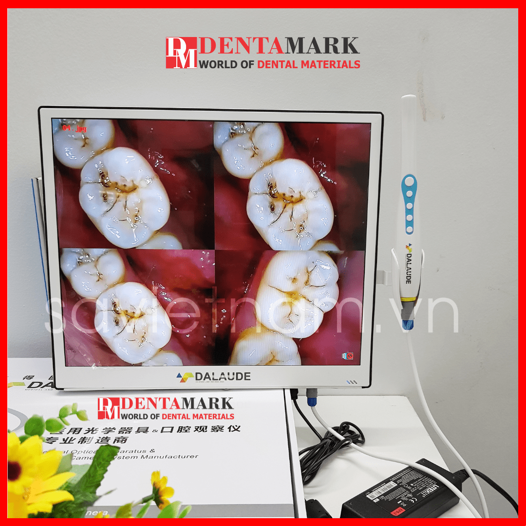 Camera Soi Răng 17" DALAUDE DA300