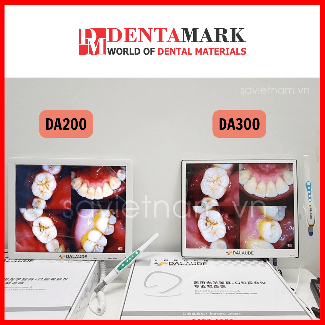 Camera Soi Răng 17" DALAUDE DA300