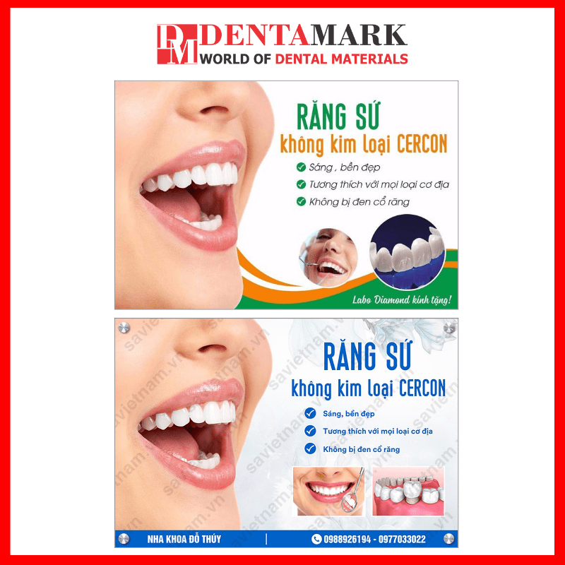 Tranh nha khoa Poster quảng cáo răng sứ không kim loại Cercon