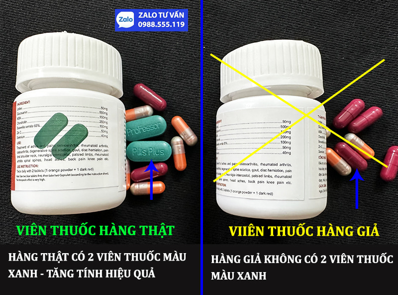 NƠI MUA THUỐC XƯƠNG KHỚP YUAN BONE MALAYSIA CHÍNH HÃNG