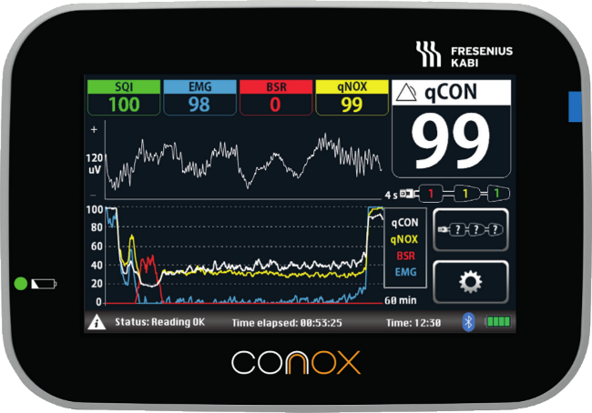 Thiết bị đo độ mê và độ đau - CONOX | Công Ty TNHH Thiết Bị Y Khoa Đông ...
