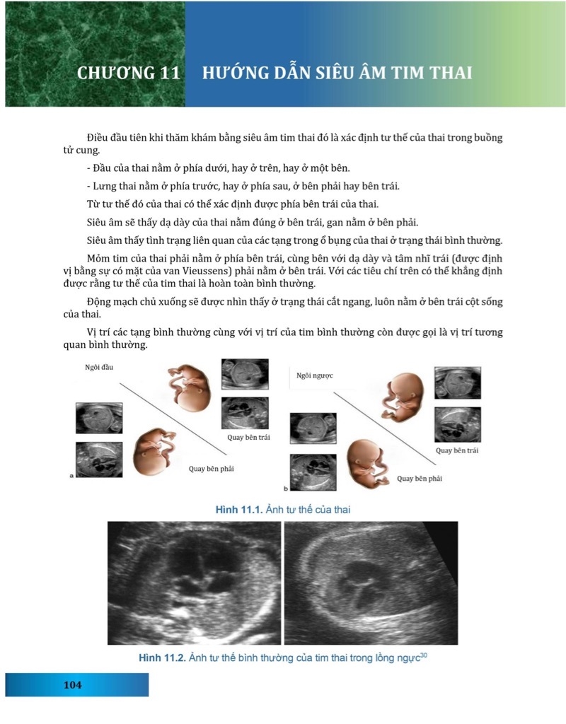 Sách Siêu âm tim thai nhi Vythietbiyte-sachyhoc