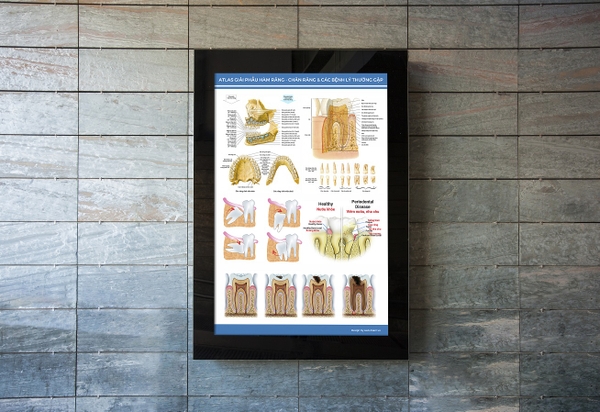 Tranh Atlas giải phẫu hàm răng - chân răng và các bệnh lý thường gặp ...