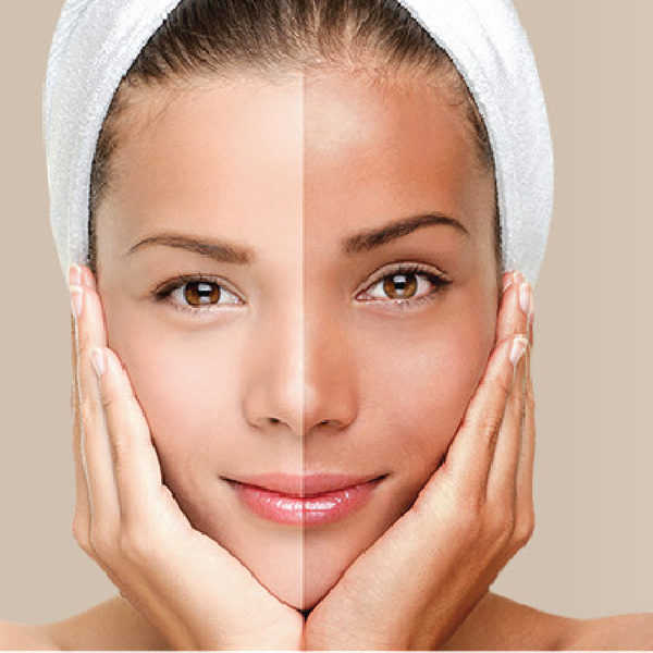 Tiêm meso trắng da : Nguyên nhân và cách điều trị hiệu quả