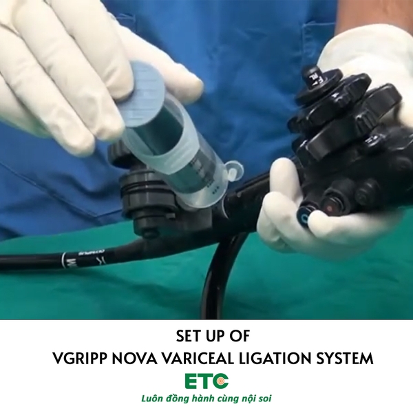 Set Up Of Vgripp Nova Variceal Ligation System Công Ty Tnhh Thiết Bị Y Tế Etc