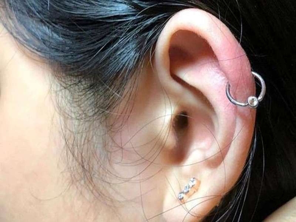 Hướng dẫn cách xử lý khi xỏ khuyên tai bị bump tại nhà Thế Giới Xỏ ...