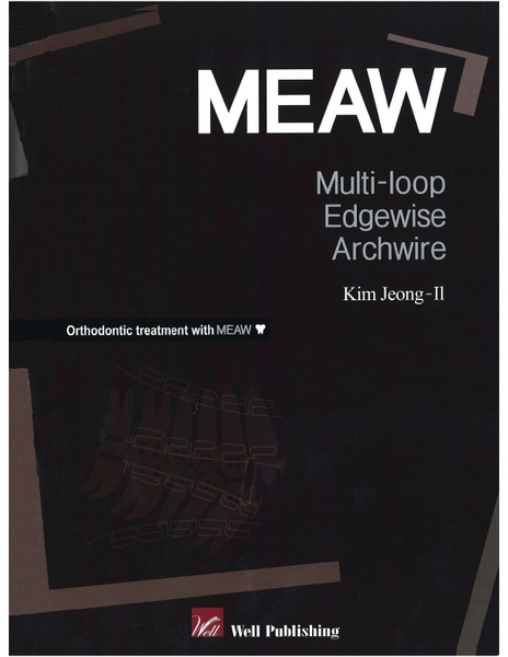 MEAW (Multi-loop Edgewise Archwire) Orthodontic Treatment with MEAW