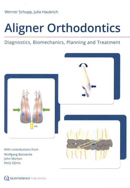 Aligner Orthodontics Diagnostic Biomechanics Planning and Treatment