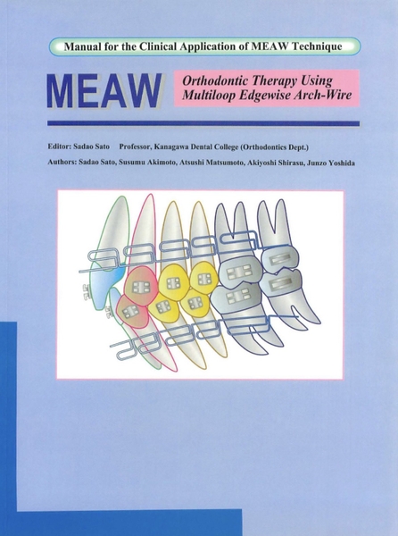 Meaw - Orthodontic Theraphy Using Multiloop Edgewise Arch-Wire