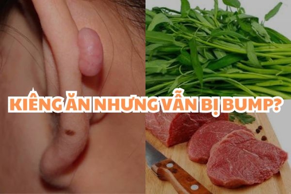 Tại sao xỏ khuyên kiêng ăn nhưng vẫn bị bump?