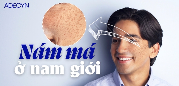 Rám má ở nam giới