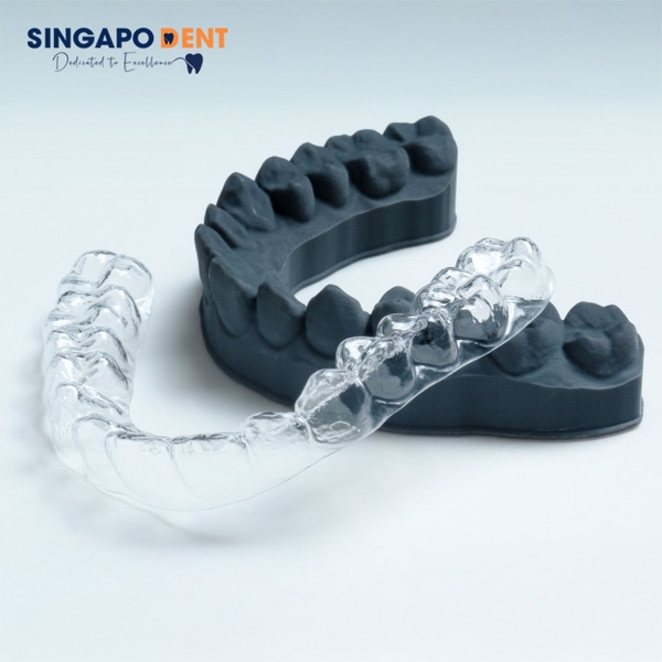TRIM+: Automated Aligner Trimmer